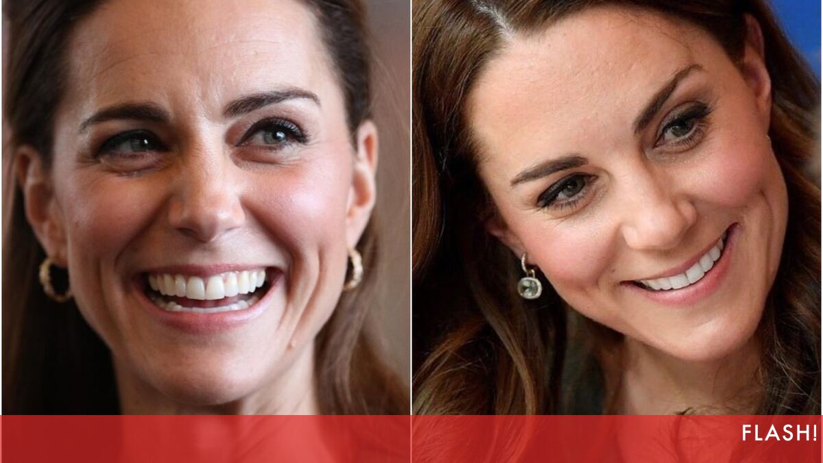 Kate Middleton já recorre a botox, diz médico, revelando segredo da ...