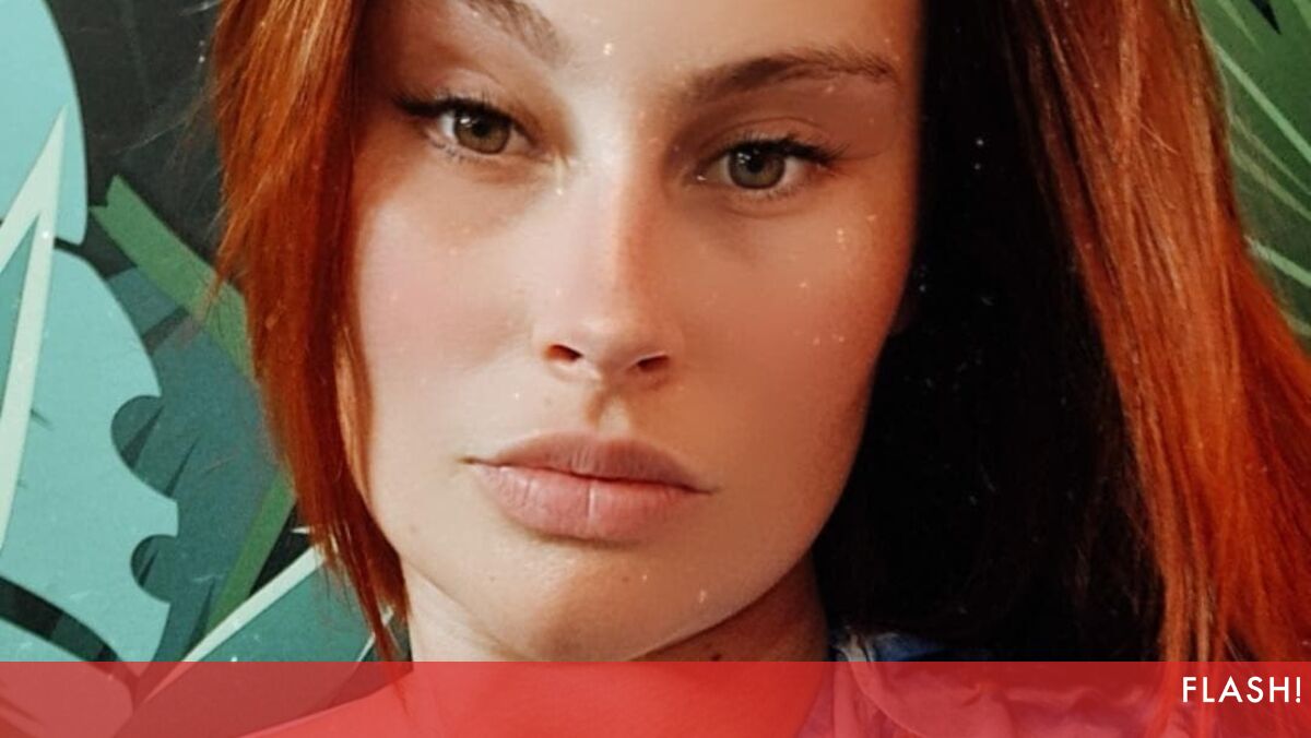 Bernardina Brito mostra lesão no braço e fala de dores - FlashTv - FLASH!